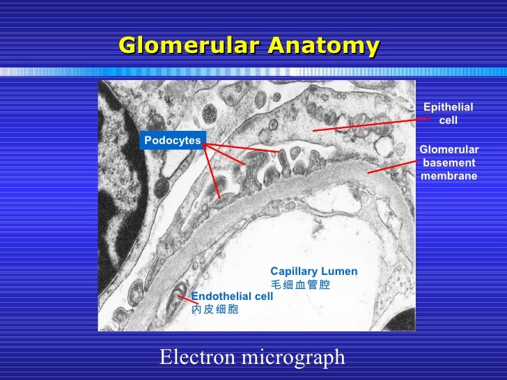 24 glomerular disease