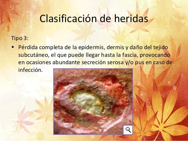 [24] heridas parte 1