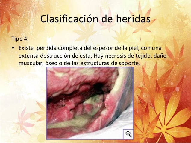 [24] heridas parte 1
