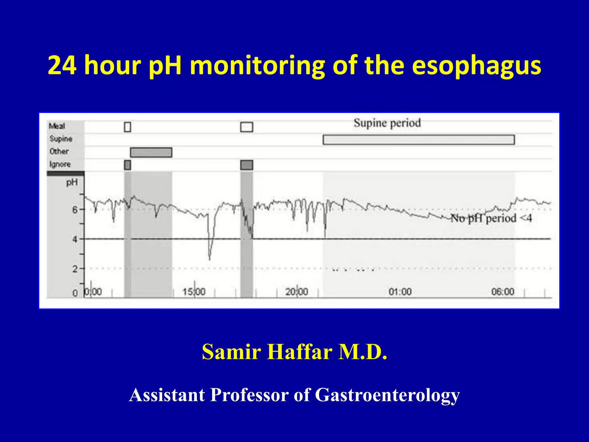 pH monitoring of the esophagus | PPTX