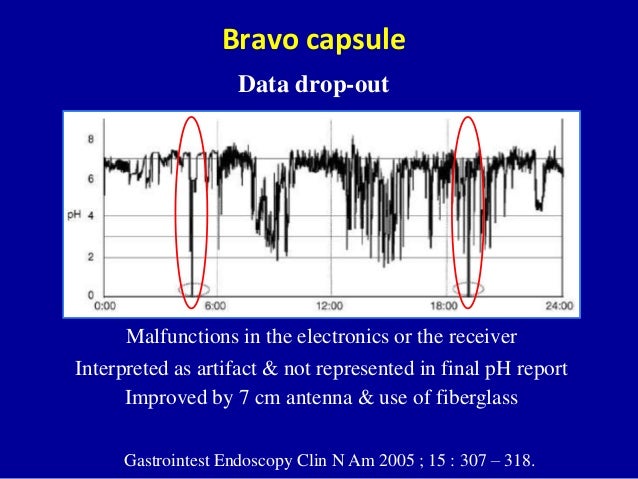 pH monitoring of the esophagus