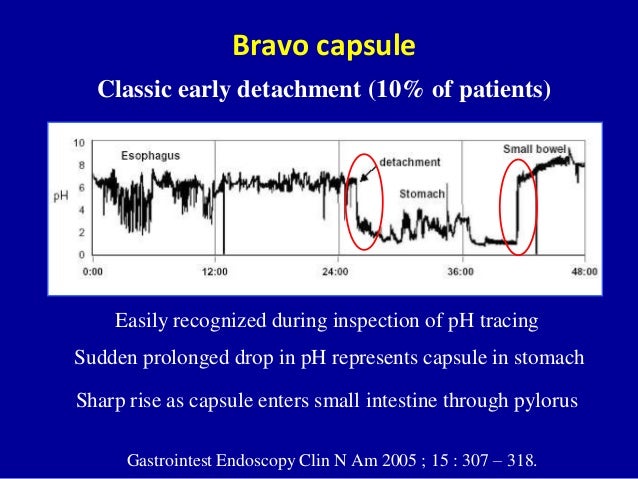 pH monitoring of the esophagus