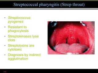 24_Microbial_Diseases_of_the_Respiratory_System (2).ppt