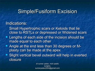 scar revision , z plasty | PPT