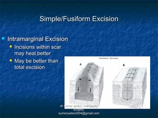 scar revision , z plasty | PPT