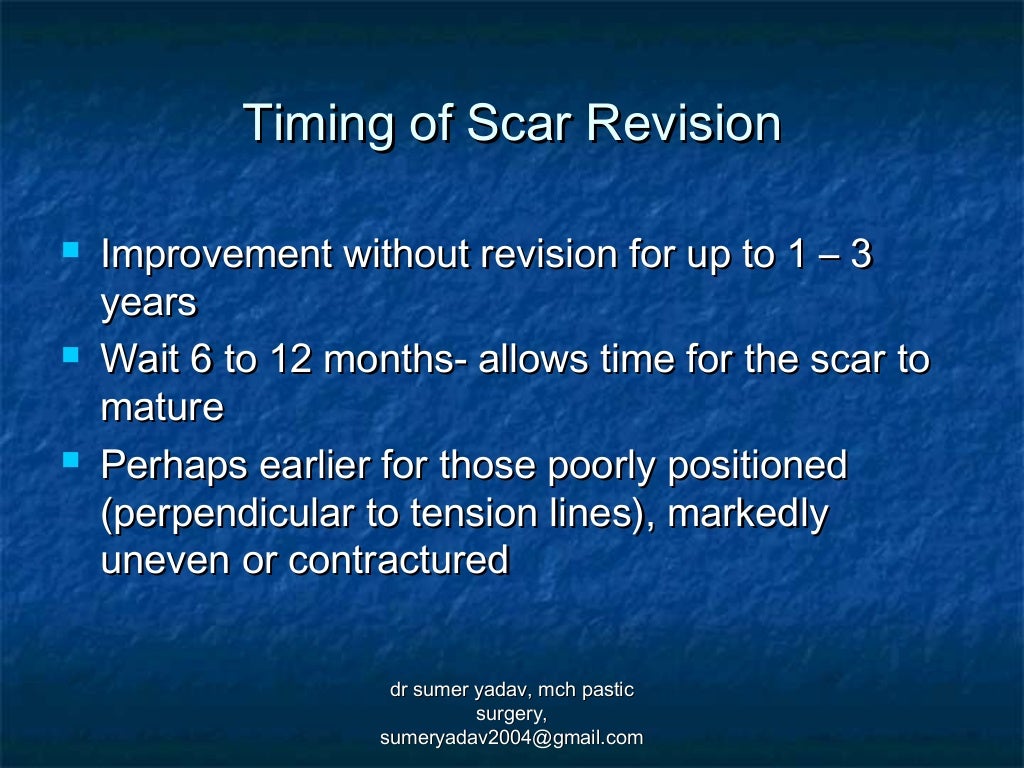 scar revision , z plasty