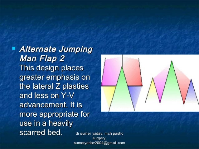 scar revision , z plasty