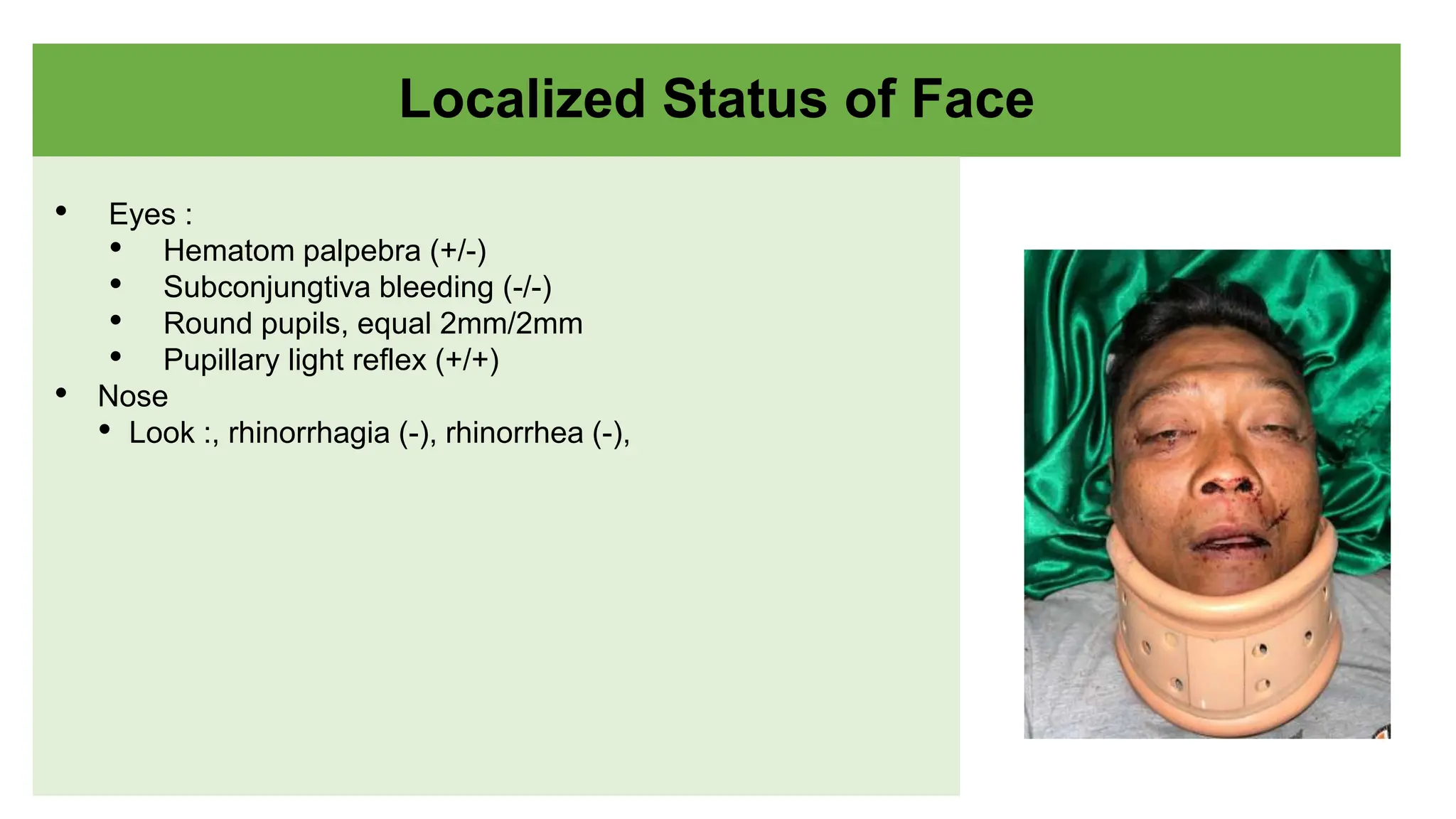 24_September_2023_Mild_TBI_GCS_14,_Contusio_Cerebri fixed.pptx