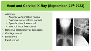 24_September_2023_Mild_TBI_GCS_14,_Contusio_Cerebri fixed.pptx