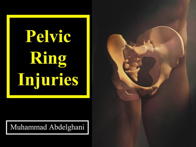 25. management of pelvic ring injuries | PPT