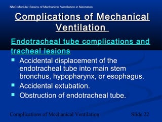 25. basics of mechanical ventilation in neonates | PPT