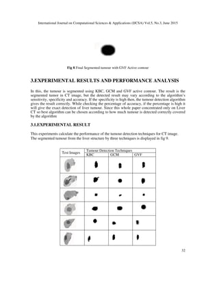 PERFORMANCE EVALUATION OF TUMOR DETECTION TECHNIQUES | PDF