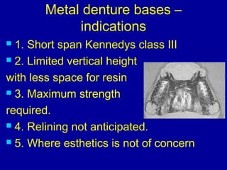 25. rpd denture bases+teeth | PPT