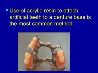 25. rpd denture bases+teeth | PPT
