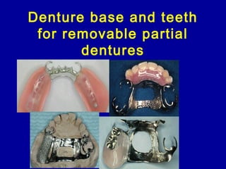 25. rpd denture bases+teeth | PPT