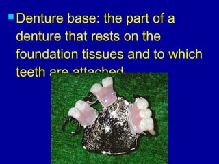 25. rpd denture bases+teeth | PPT