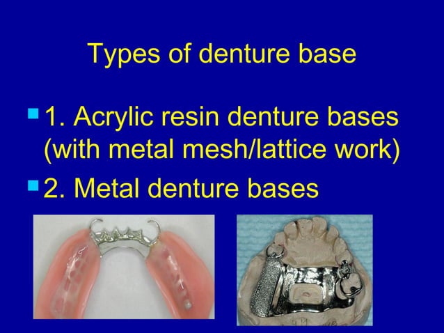 25. rpd denture bases+teeth | PPT | Oral care | Personal Care