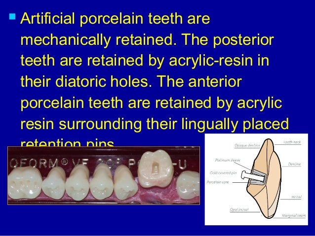 25. rpd denture bases+teeth