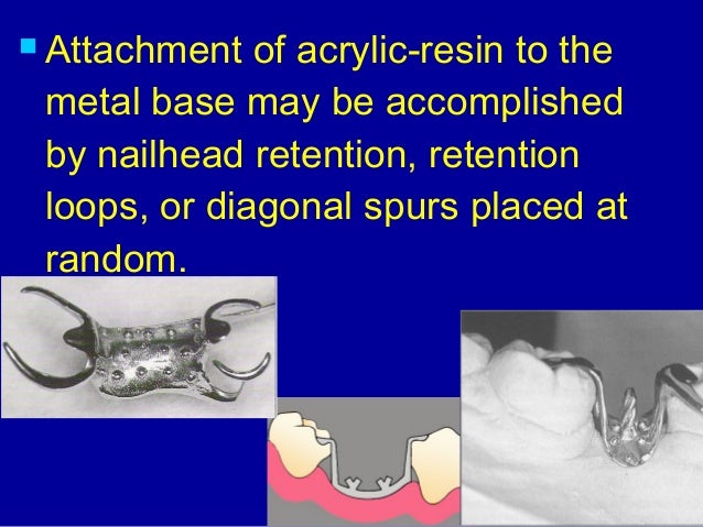 25. rpd denture bases+teeth