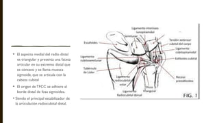 Fracturas de radio distal en niños y adultos mayores | PPTX