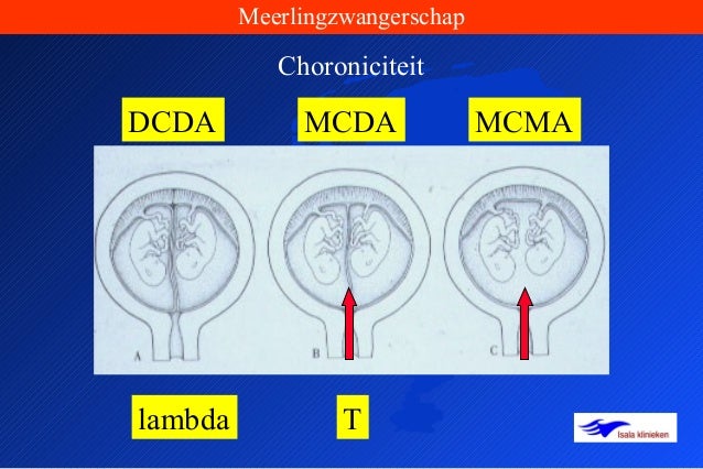 25 3-14 ohc meerlingzwangerschap amstelacademie
