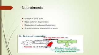 classification and diagnostic methods of peripheral nerve injury | PPTX