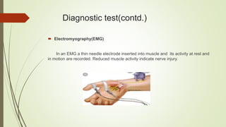 classification and diagnostic methods of peripheral nerve injury | PPTX