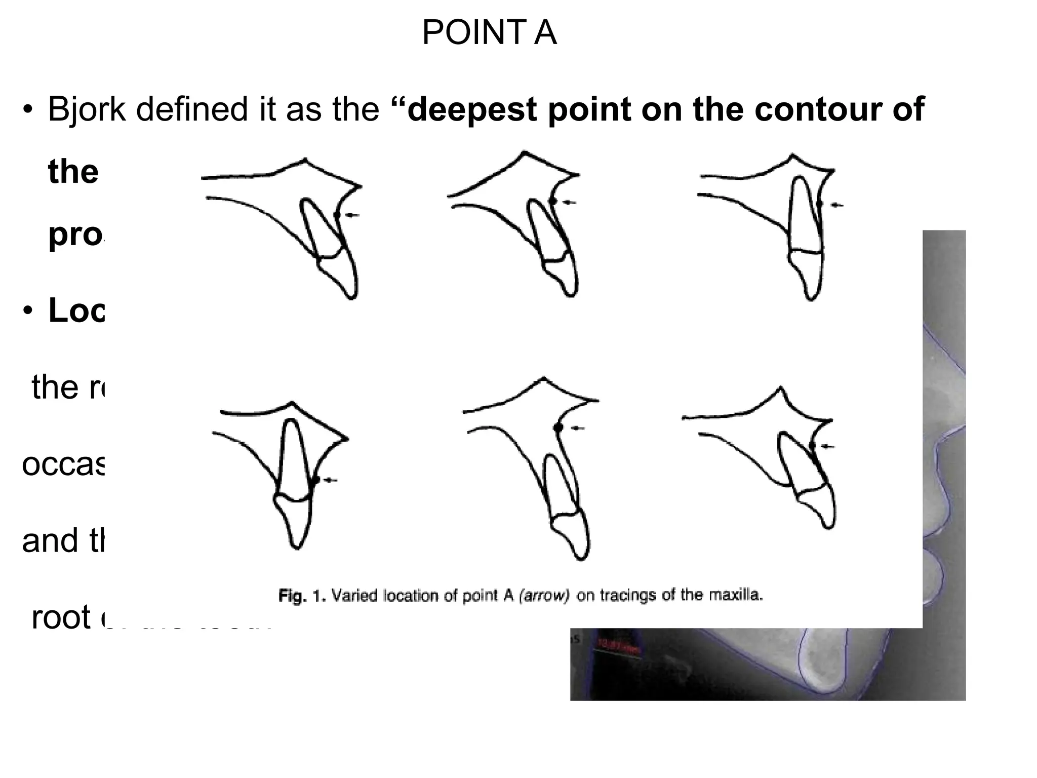 dipaolos analysis point A revisited with articles | PPTX