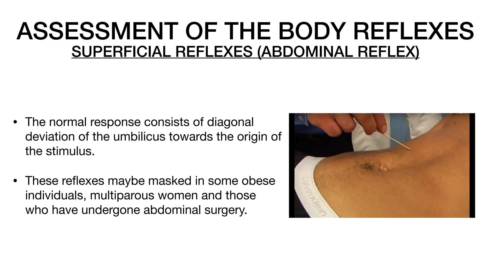 Assessment of the Spinal Nerves (The Sensory and Motor Functions) & The ...