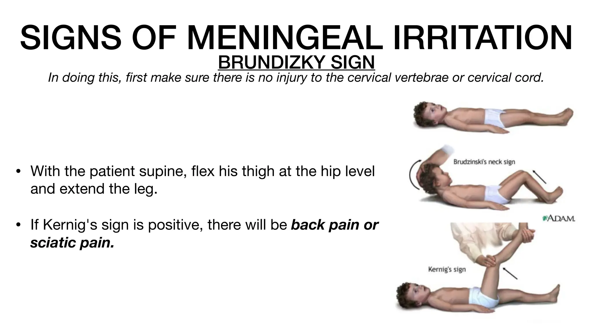 Assessment of the Spinal Nerves (The Sensory and Motor Functions) & The ...