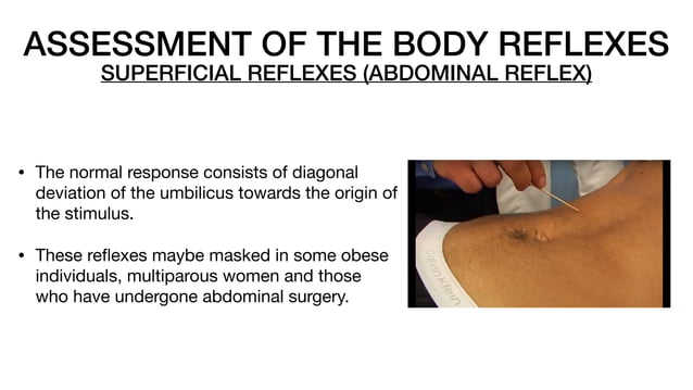 Assessment of the Spinal Nerves (The Sensory and Motor Functions) & The ...