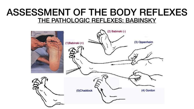 Assessment of the Spinal Nerves (The Sensory and Motor Functions) & The ...