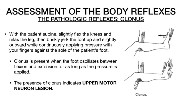 Assessment of the Spinal Nerves (The Sensory and Motor Functions) & The Reflexes.pdf