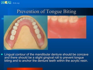 25.final wax contouring | PPT