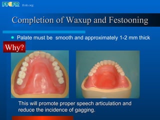 25.final wax contouring | PPT