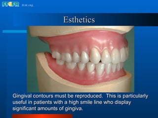 25.final wax contouring | PPT