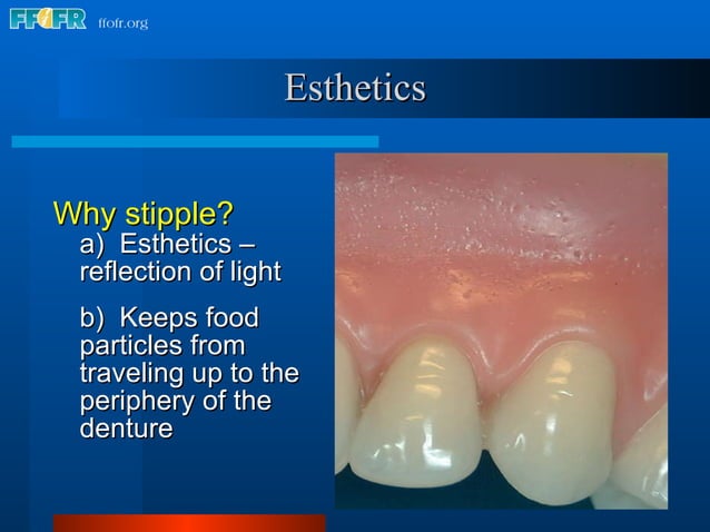 25.final wax contouring | PPT