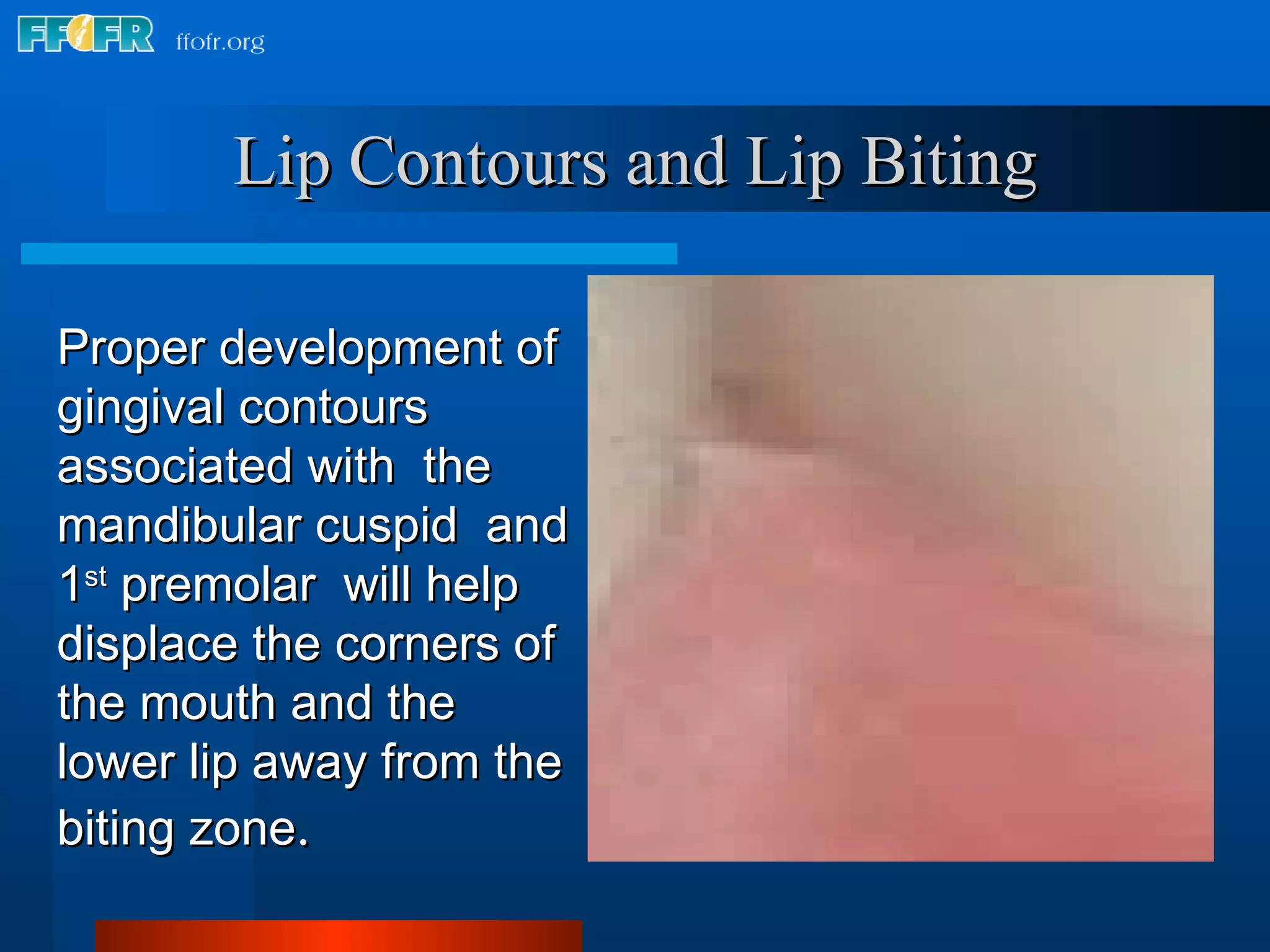 25.final wax contouring | PPT