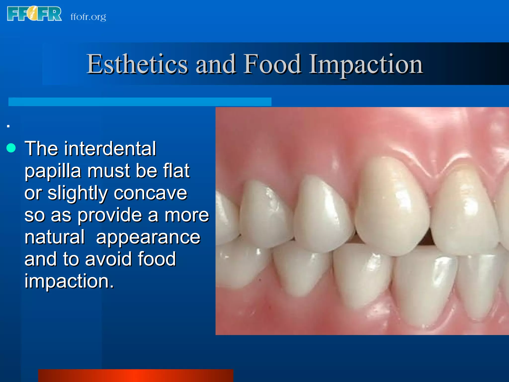 25.final wax contouring | PPT