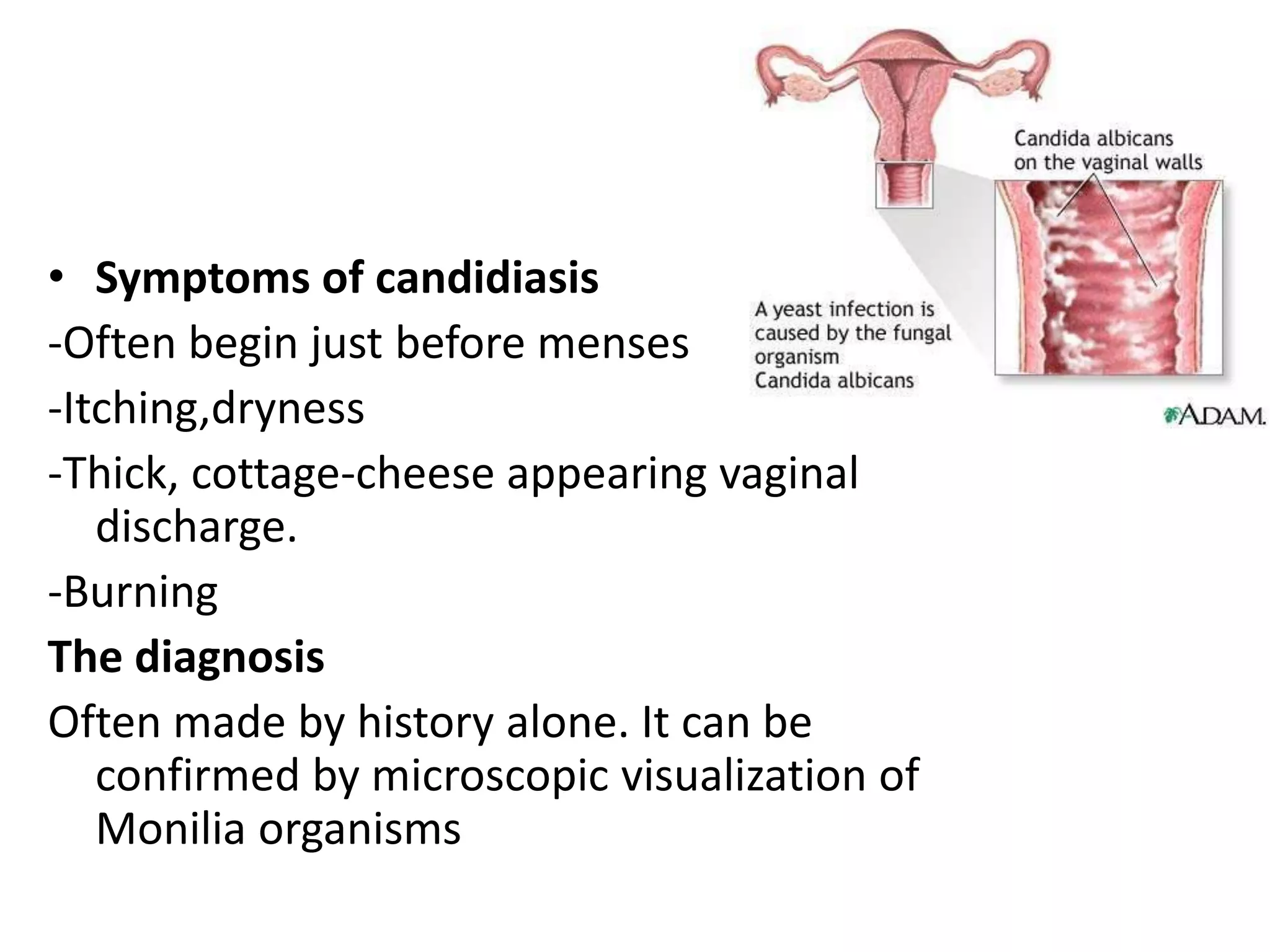 25- Genital tract infection.ppt