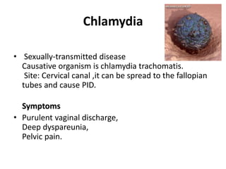 25- Genital tract infection.ppt