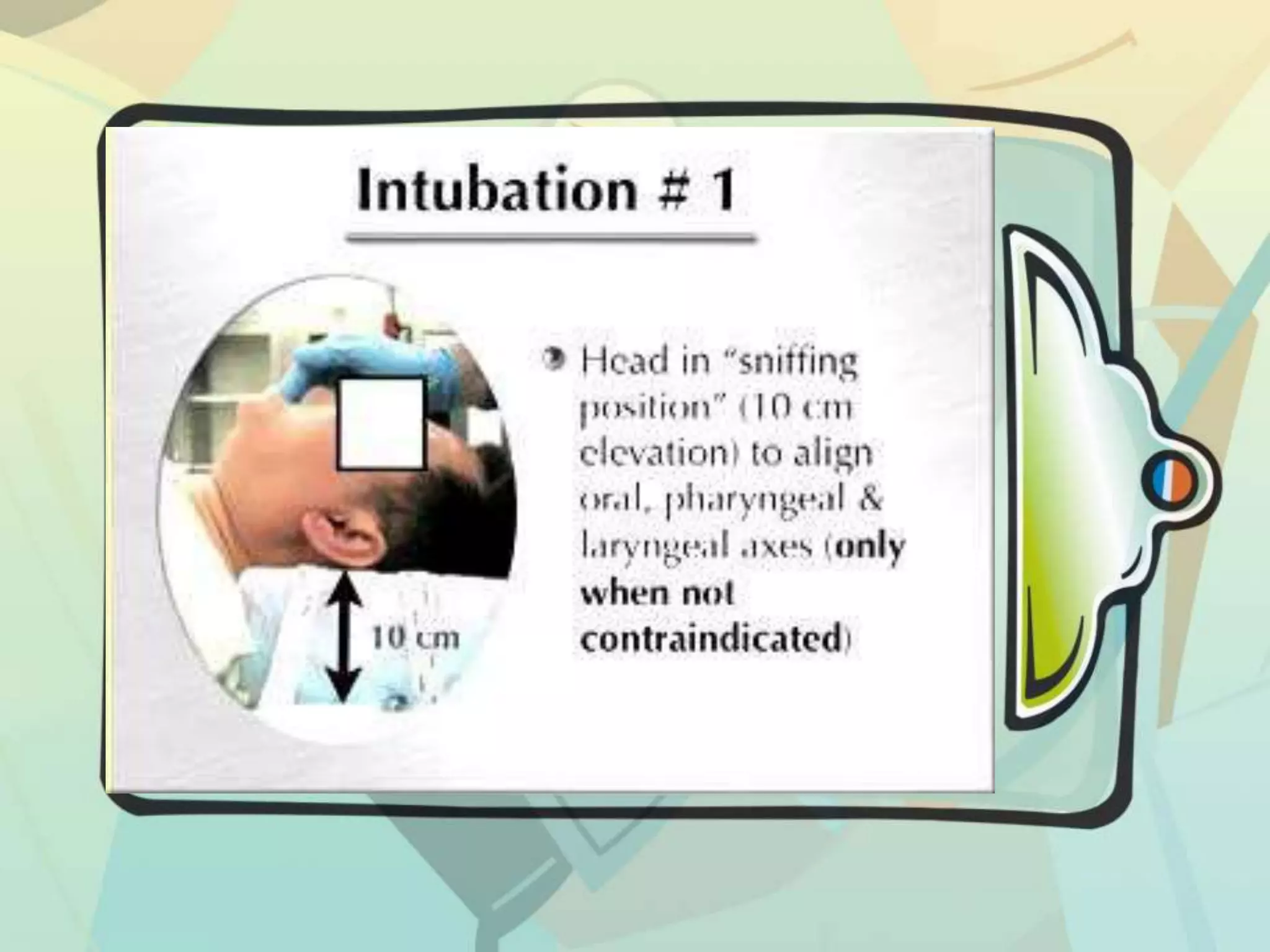 251052812-Endotracheal-Tube-Intubation.pptx
