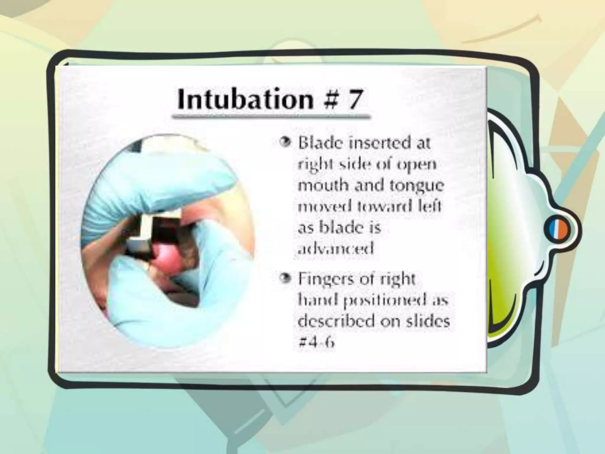 251052812-Endotracheal-Tube-Intubation.pptx