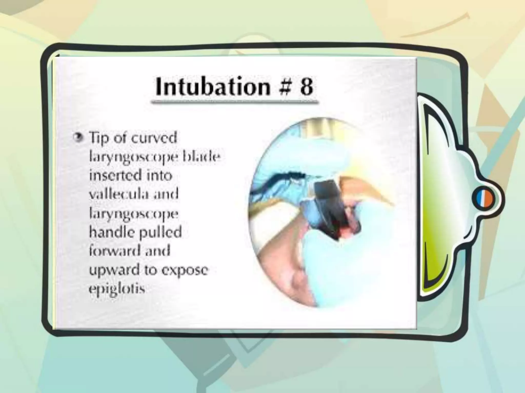 251052812-Endotracheal-Tube-Intubation.pptx