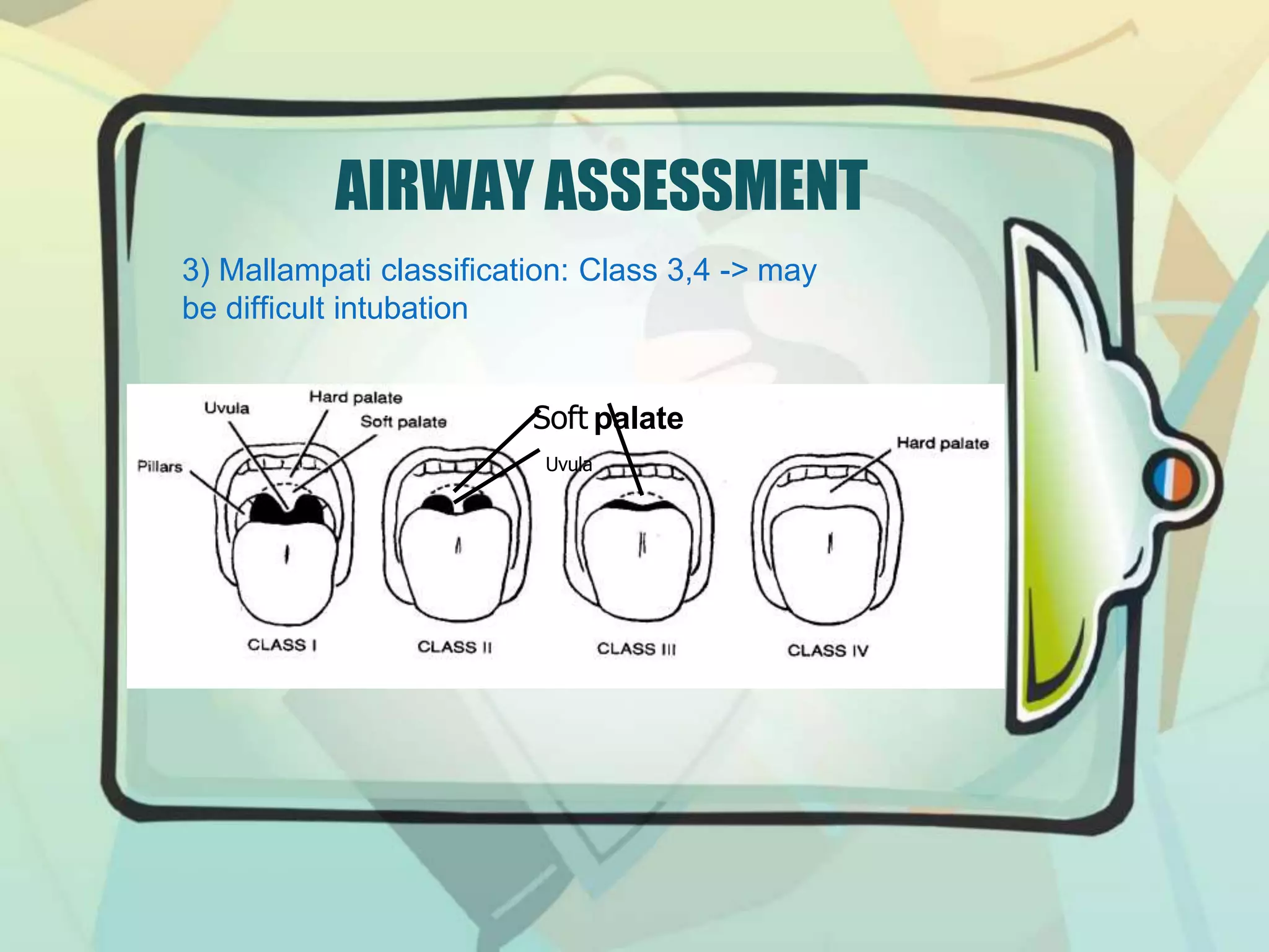 251052812-Endotracheal-Tube-Intubation.pptx