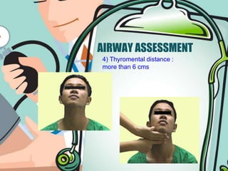 251052812-Endotracheal-Tube-Intubation.pptx