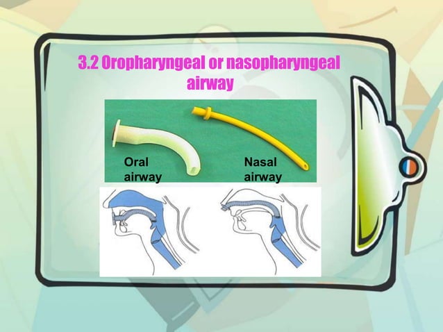 251052812-Endotracheal-Tube-Intubation.pptx