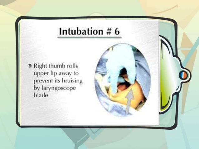 251052812-Endotracheal-Tube-Intubation.pptx