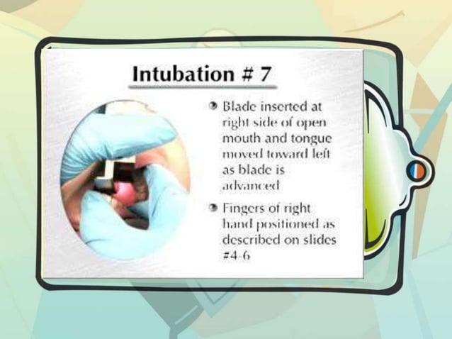 251052812-Endotracheal-Tube-Intubation.pptx
