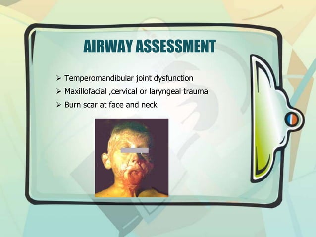 251052812-Endotracheal-Tube-Intubation.pptx